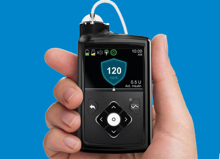 World's first artificial pancreas approved in US | Science News | Inshorts