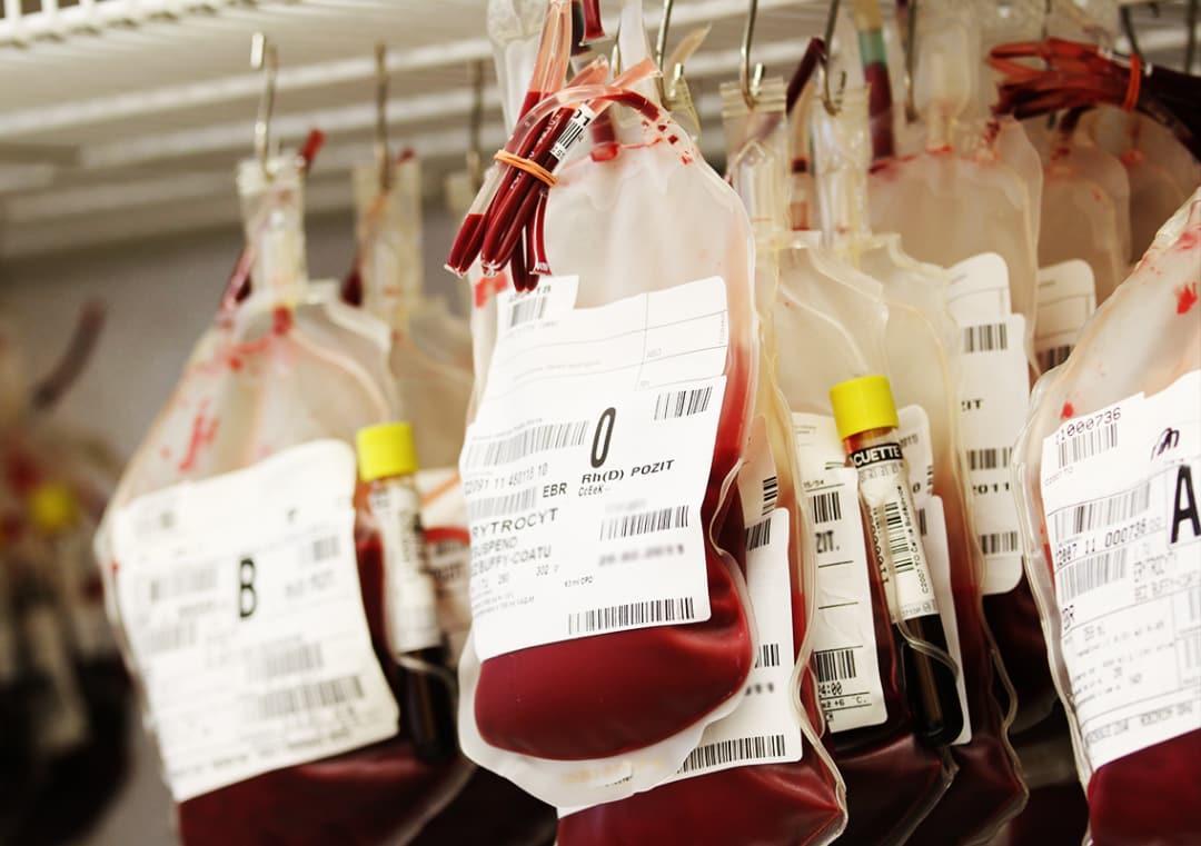5 men held for selling blood mixed with 50% saline water | National ...