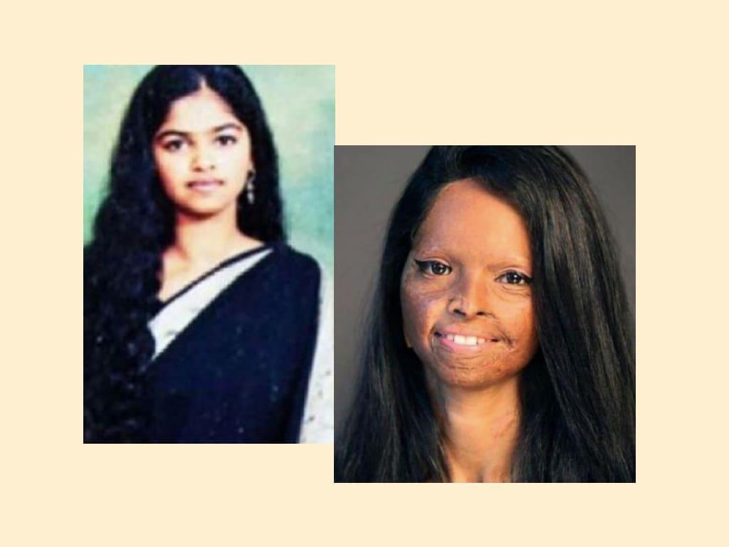 Who is Laxmi Agarwal, the acid attack survivor Deepika is playing ...