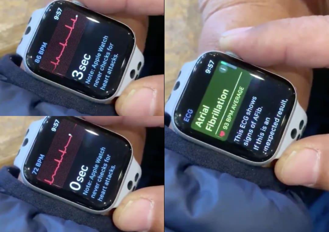 Doctor uses Apple Watch to diagnose heart condition in restaurant